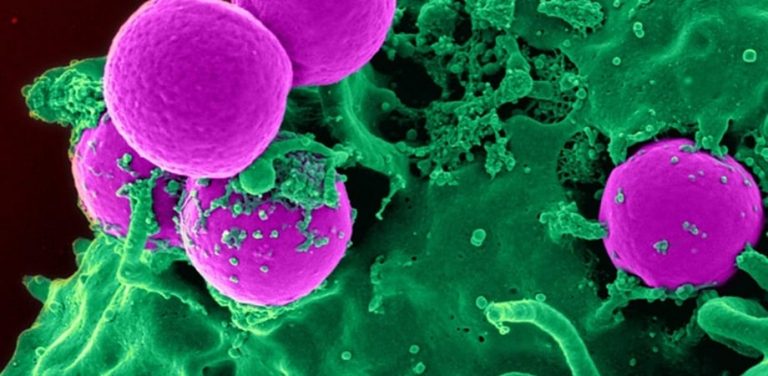 Limfocite crescute la adulti sau copii - ce inseamna - Mami si copilul