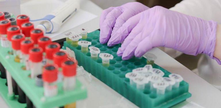 Trombocite crescute la adulti sau copii - ce inseamna - Mami si copilul