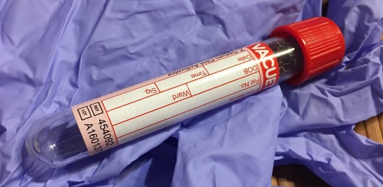 Eritrocite crescute la adulti sau copii - ce inseamna - Mami si copilul